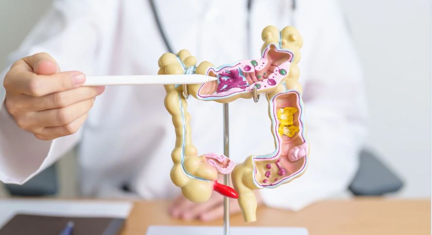 How to Clean Out Bowels Quickly? | How To Cleaning Blog